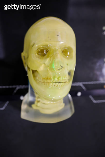 Human tissue mimicking mannequin head on a medical linear accelerator ...