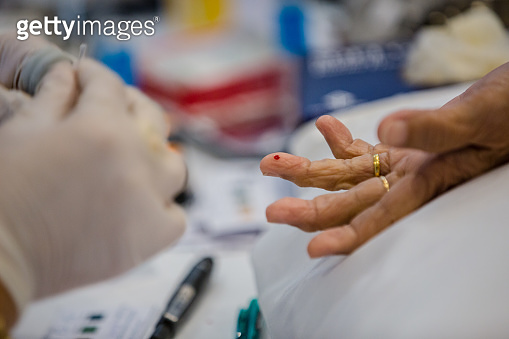 Process of drawing blood from a finger for hematocrit test. (1164731447 ...