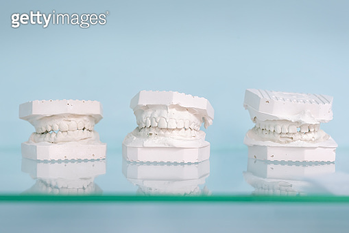 Different gypsum human jews model on glass shelf at dentist office on ...