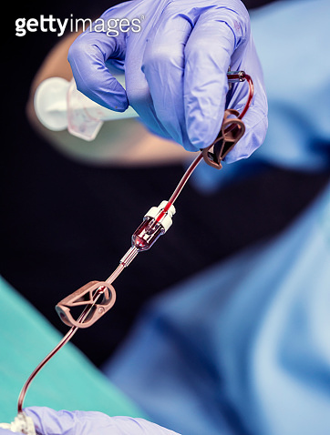 Nurse prepares Venous catheters of Long Duration in a hospital ...