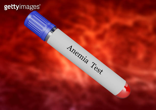 Blood anemia test collected in test tube isolated by selective focus ...