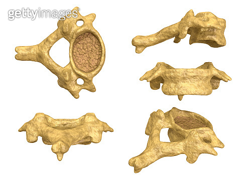 morphology of the cervical vertebra, sixth cervical vertebra, multiple ...