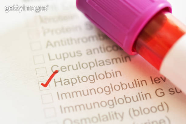 Blood sample tube for haptoglobin test (1170736042) - 게티이미지뱅크