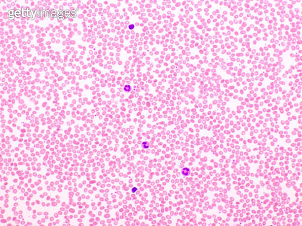 Picture of blood cells in blood film (1183151484) - 게티이미지뱅크