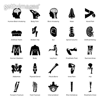 Pack Of Orthopedic Prosthesis Medical Implants Artificial Body Parts ...