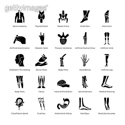 Bundle Of Orthopedic Prosthesis Medical Implants Artificial Body Parts ...