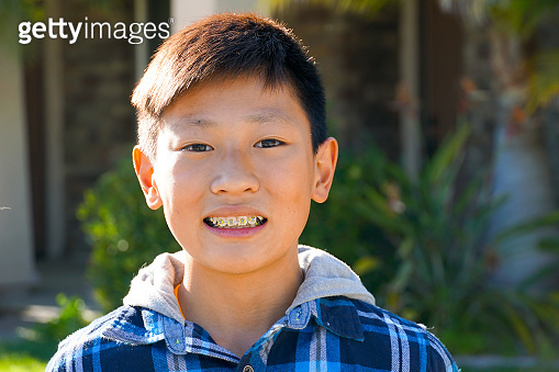Portrait of young Asian kid boy with tooth braces. 이미지 (1132428340 ...