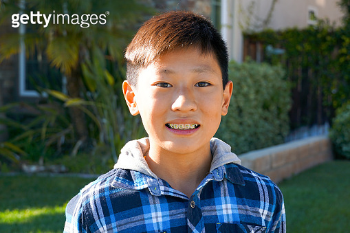 Portrait of young Asian kid boy with tooth braces. 이미지 (1132424924 ...