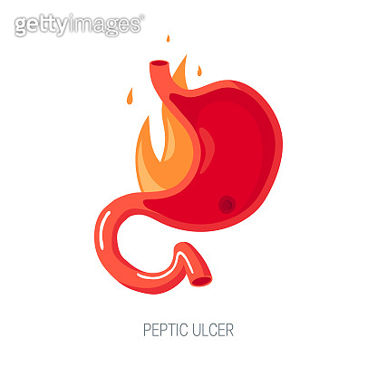 Peptic ulcer concept in flat style, vector icon 이미지 (1134894111) - 게티이미지뱅크