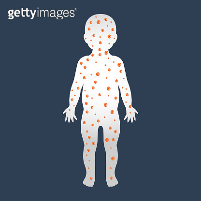 Rubella German Measles logo icon design, vector illustration ...