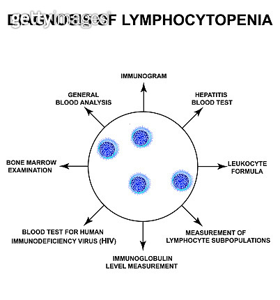 Diagnosis of lymphocytopenia. Decreased lymphocytes in the blood ...