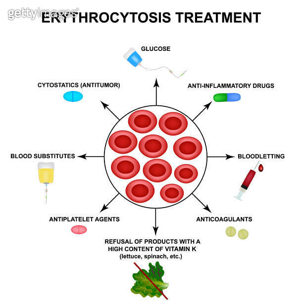 Erythrocytosis treatment. Increased red blood cells. Cells erythrocytes ...