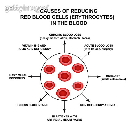 Causes of Reducing Red Blood Cells. Cells erythrocytes. Hemoglobin. The ...
