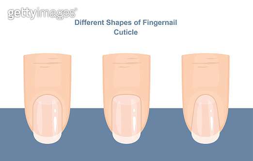 Different Shapes of Fingernail Cuticles. Manicure Guide. Vector ...