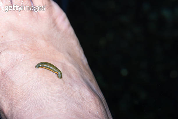 Aquatic Leech sucking blood on skin,Leeches were used in medicine from ...