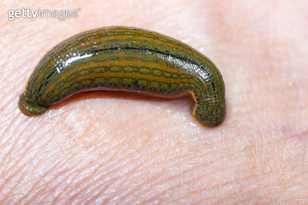 Aquatic Leech sucking blood on skin,Leeches were used in medicine from ...