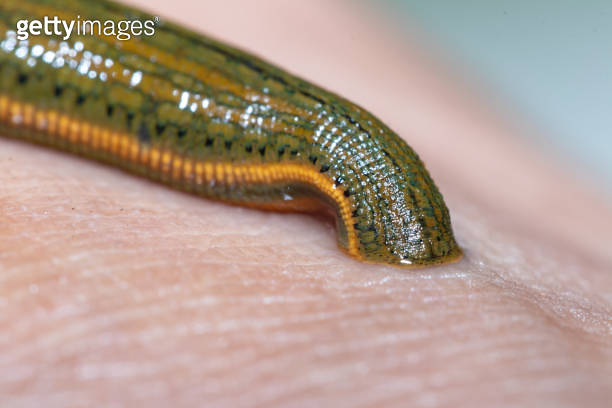 Aquatic Leech sucking blood on skin,Leeches were used in medicine from ...