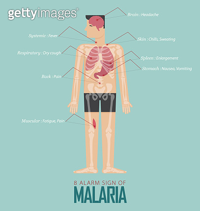 Alarm signs of Malaria infographic in flat design. Malaria disease symptom icon set with human ...