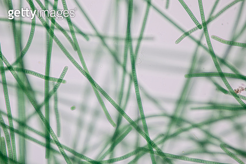 Study of Oscillatoria is a genus of filamentous cyanobacterium ...