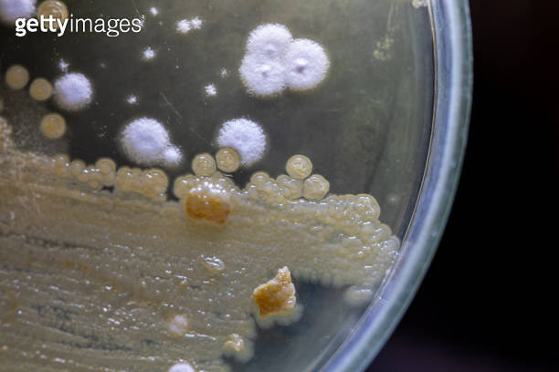 Mold Beautiful, Colony of Characteristics of Fungus (Mold) in culture ...
