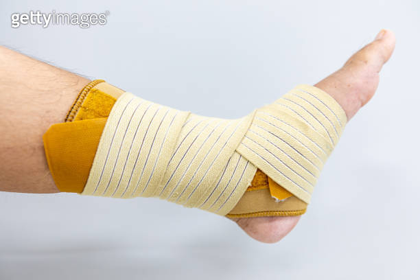 Closeup injured at leg, Fresh wounds from accident. (1181203162) - 게티이미지뱅크