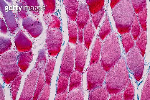 Education anatomy and Histological sample Striated (Skeletal) muscle of ...
