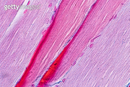 Education anatomy and Histological sample Striated (Skeletal) muscle of ...