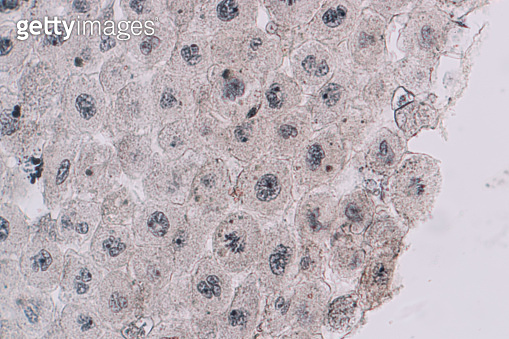 Education of Grasshopper testis under the microscope in Lab ...