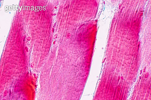 Education anatomy and Histological sample Striated (Skeletal) muscle of ...