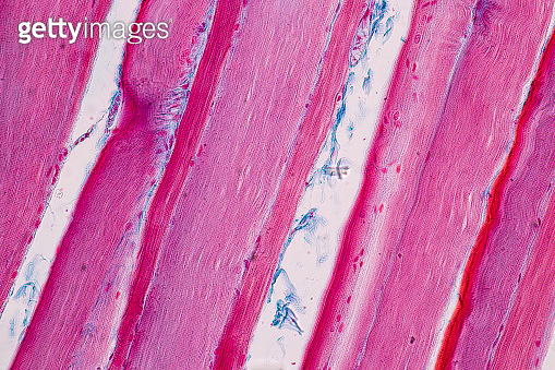 Education anatomy and Histological sample Striated (Skeletal) muscle of ...