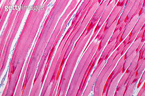 Education anatomy and Histological sample Striated (Skeletal) muscle of ...