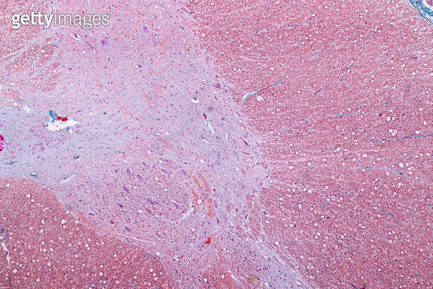 Education anatomy and Histological sample Spinal cord Tissue under the ...