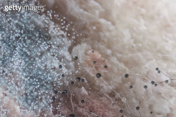 Rhizopus (bread mold) is a genus of common saprophytic fungi,Rhizopus ...