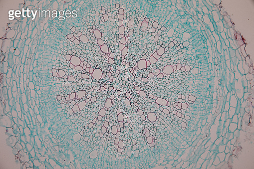 Cross-section Dicot, Monocot and Root of Plant Stem under the ...