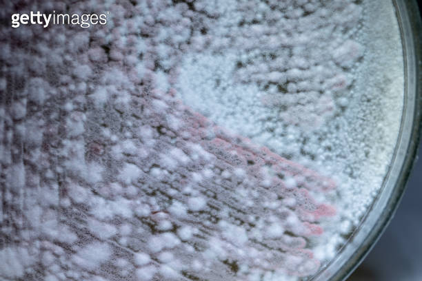 Mold Beautiful, Colony of Characteristics of Fungus (Mold) in culture ...