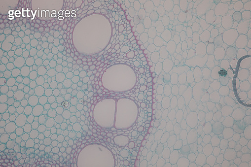 Cross-section Dicot, Monocot and Root of Plant Stem under the ...