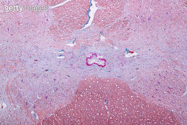 Education anatomy and Histological sample Spinal cord Tissue under the ...