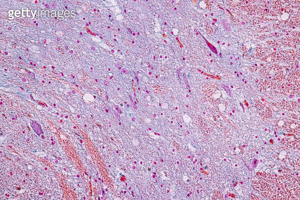Education anatomy and Histological sample Spinal cord Tissue under the ...
