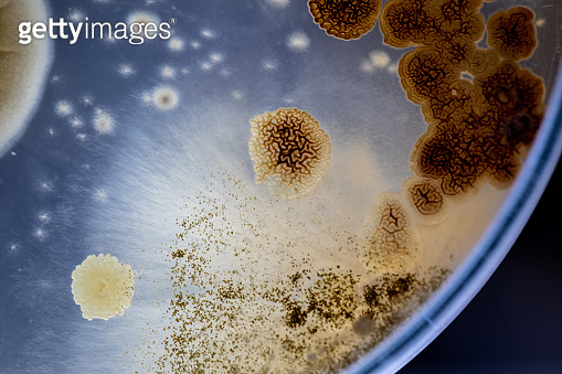 Mold Beautiful, Colony of Characteristics of Fungus (Mold) in culture ...