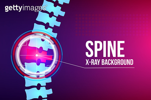 Creative vector illustration of spine x-ray, pain neck, disk ...