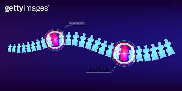Creative vector illustration of spine x-ray, pain neck, disk ...