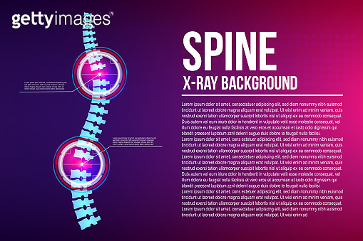 Creative vector illustration of spine x-ray, pain neck, disk ...
