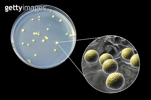 Colonies of Micrococcus luteus bacteria on agar plate 이미지 (1148144689 ...