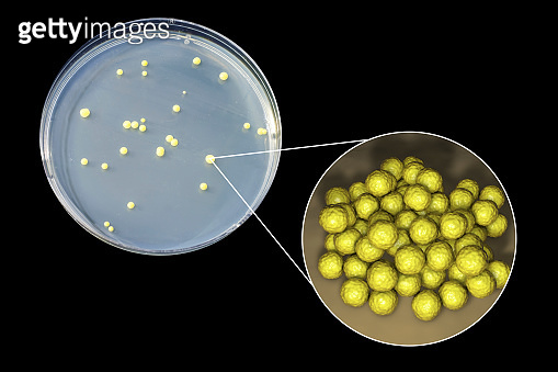 Colonies of Micrococcus luteus bacteria on agar plate 이미지 (1148144587 ...