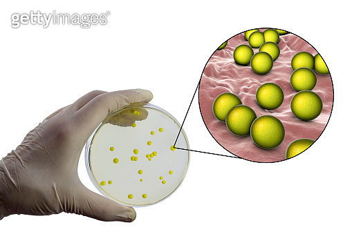 Colonies of Micrococcus luteus bacteria on agar plate (1148144307) - 게티 ...
