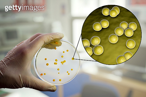 Colonies of Micrococcus luteus bacteria on agar plate (1148143731) - 게티 ...