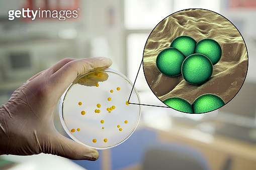 Colonies of Micrococcus luteus bacteria on agar plate (1148143540) - 게티 ...