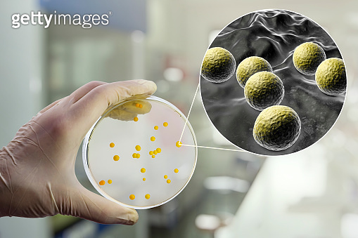 Colonies of Micrococcus luteus bacteria on agar plate 이미지 (1148143443 ...