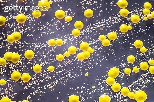 Bacteria grown from skin smear, colonies of Micrococcus luteus and ...