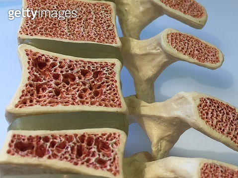 Anatomical model of Cross-section of spinal column and vertebral bodies ...